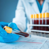 Testosterone Blood Test Results Explained - Total and Free Testosterone