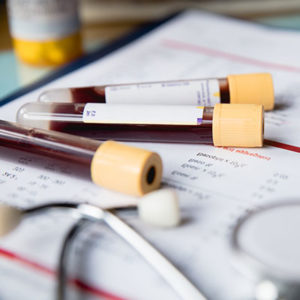 How Do Doctors Test for HGH Deficiency?