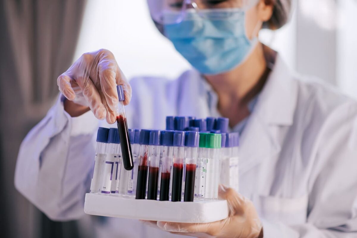 HGH Injections vs. Secretagogues: How Do They Compare? - HGH Therapy Doctor